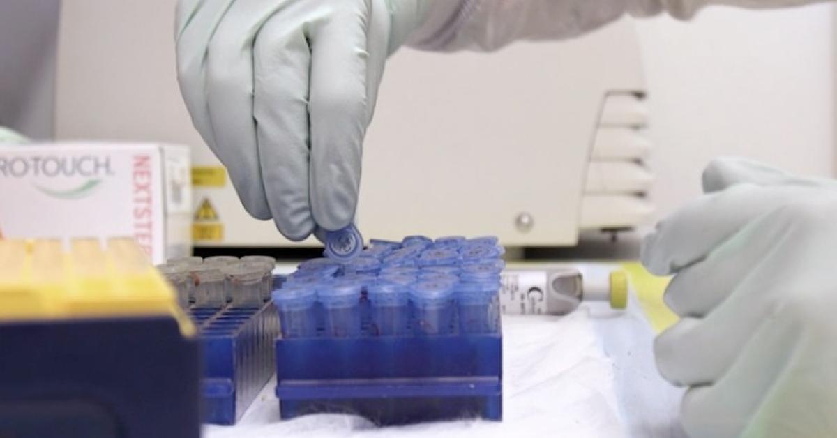 Potential HIV Vaccine Component Proves Effective in Primate Study ...